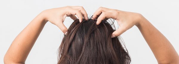 Eczéma du cuir chevelu et démangeaisons : que faire ? | NEUTRADERM